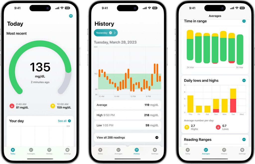 Glucomate Helps You Analyze Blood Glucose Trends